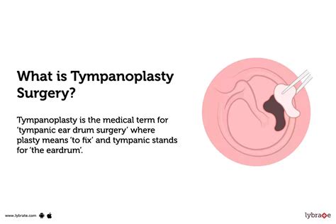 Tympanoplasty Types