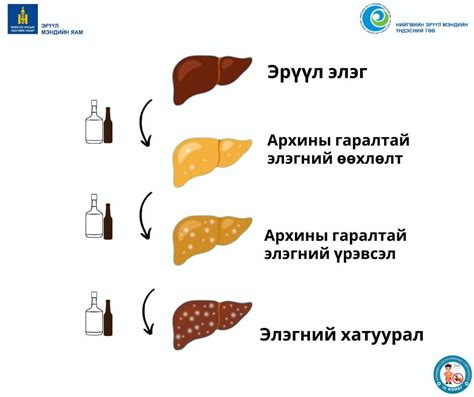 Цэн Оюу ӨЭМТ Архидын согтуурахын эсрэг 15 хоног “ 📢 Facebook