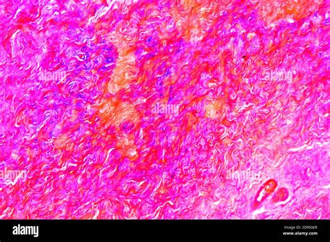 Fibrocartilage Tissue Showing Collagen Fibers Optical Microscope X100