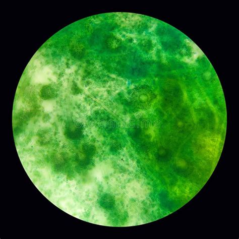 Aspergillus Flavus Stock Image Image Of Flavus Microscope 380512271