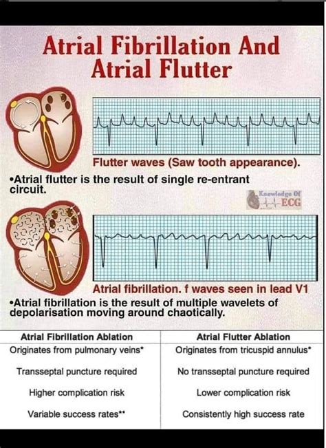 The Heart 🔴atrial Fibrillation Vs Atrial Flutter ⤵️🔹