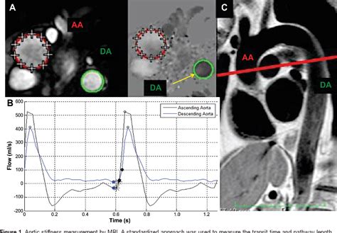 Figure 1 From Gender Specific Differences In Myocardial Deformation And