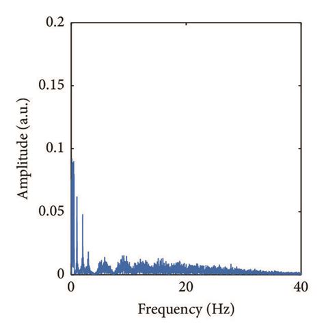 A Exemplary Ecg Signal Corrupted By An Arbitrary Realization Of The