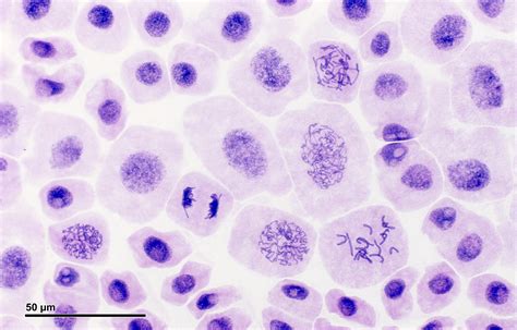 What Do The Stages Of Mitosis Look Like Under A Microscope Images