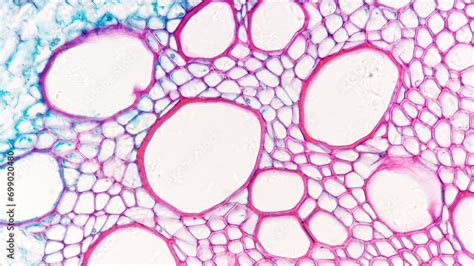 Xylem Tissue Of Sunflower Helianthus Sp Root Cross Section Of Dicot