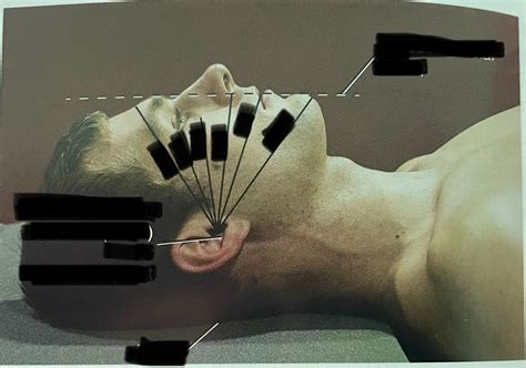 Positioning Lines Diagram Quizlet