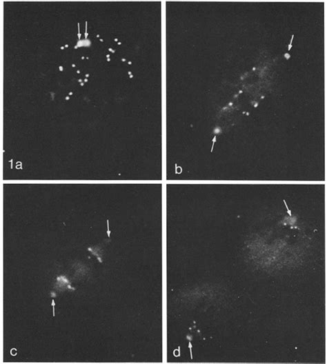 Immunofluorescent Localization Of Scleroderma Anticentromere Serum In