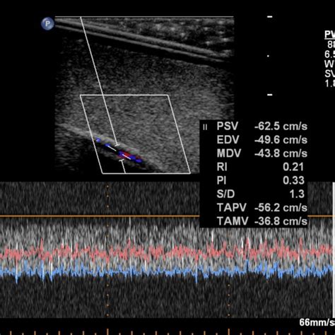 Continuous Flow Automated Measurements Of Various Parameters Download Scientific Diagram
