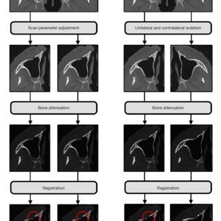 Multiscale Structural Similarity MS SSIM Index Means And Ranges For Download Scientific