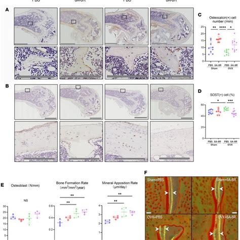 Histological And Histomorphometric Analysis Of The Distal Part Of The