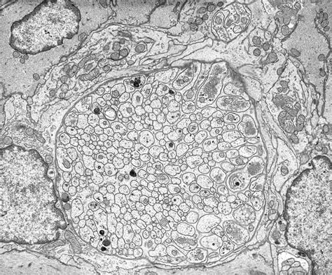 Myenteric Nerve Plexus Tem Photograph By Science Photo Library Fine