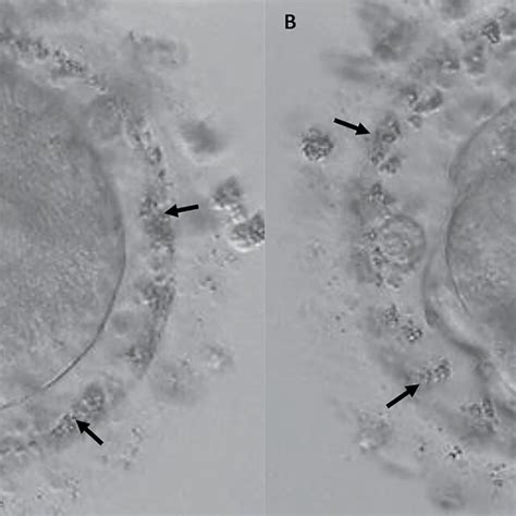 Embryonic Development Of An Oocyte With Coarse Granules In The Pvs
