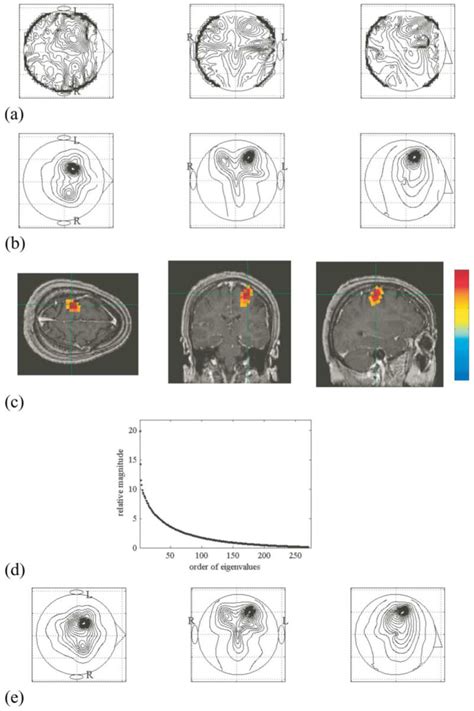 Results Of The Source Reconstruction Experiment Using Hand Motor Meg