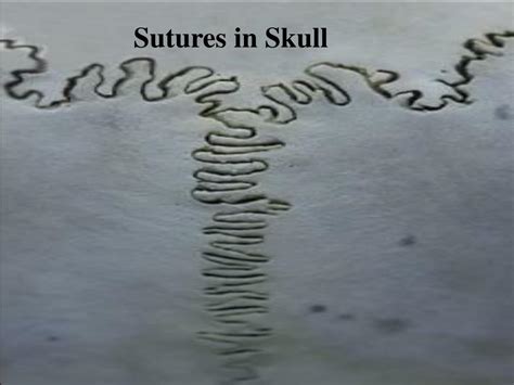 Ppt Identification Of Human Remains Powerpoint Presentation Free