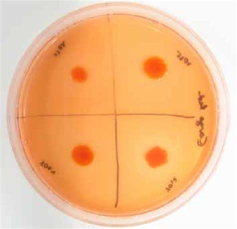 Figure 22 From Molecular Characterisation Of Flavobacterium Spp And Investigation Of Their