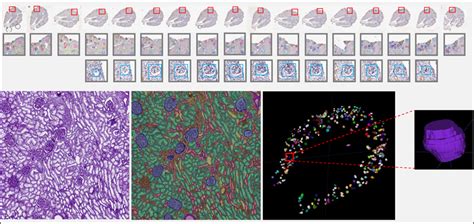 vanderbilt engineer wins 2 7m nih grant to develop ai empowered 3d computer vision tool to