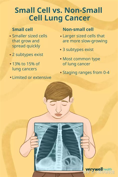 非小细胞肺癌 Non Small Cell Lung Cancer 知乎