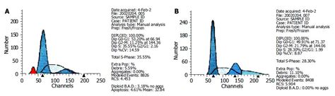 Effects Of Phosphorothioate Anti Sense Oligodeoxynucleotides On Colorectal Cancer Cell Growth