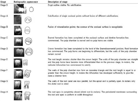 The Dental Maturation Levels According To The Demirjians Method 16 Download Scientific Diagram