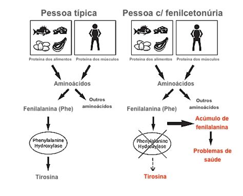 Tratamento De Fenilcetonuria