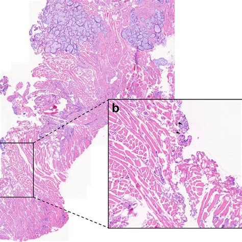 Shows Representative Histopathologic Hande Stains Of Tissue Sample Slides