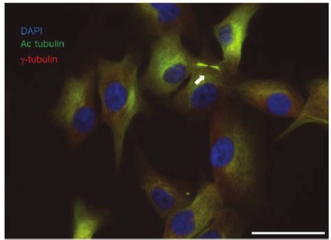 Primary Culture Of Mesothelioma Grown In The Absence Of Serum And In 3 Download Scientific
