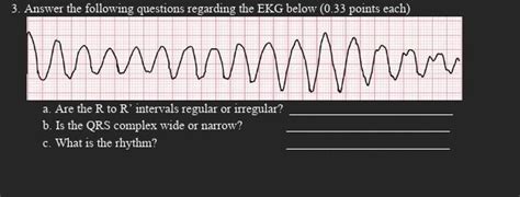 Solved A Are The R To R Intervals Regular Or Irregular Chegg Com