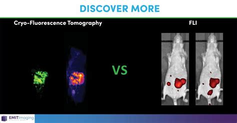 How Cft Improves Cancer Imaging Emit Imaging Posted On The Topic