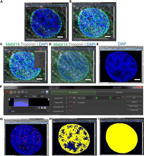 Obtain Max Projection And Define Binary A Z Stack Image Of Nucleus
