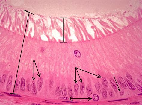 Microscope Id Epididymis Diagram Quizlet