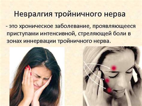 Невралгия тройничного нерва симптомы и лечение