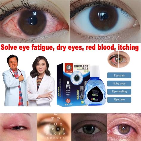 Eye Drop Japan For Dry Eye Ubat Mata Jepun Ubat Mata Merah Relieve Eye