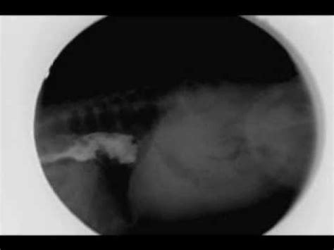 Fluoroscopia De Perro Con Megaesofago Youtube