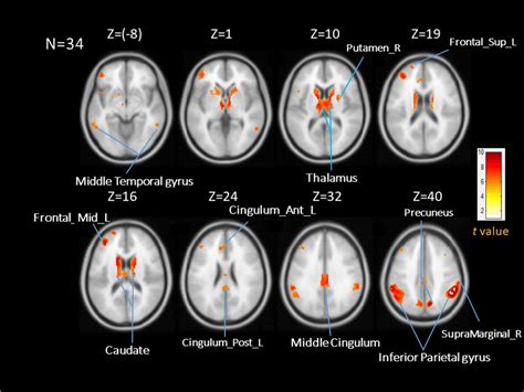 Averaged Brain Activation Maps For The Full Group Of Participants