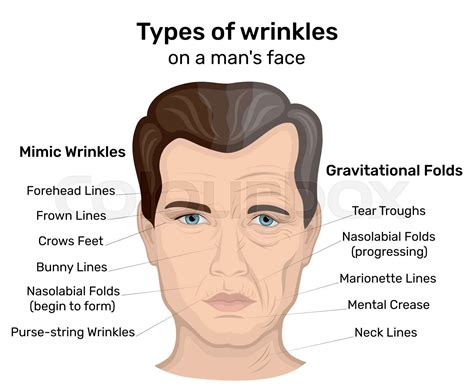 Types Of Wrinkles On A Man S Face Stock Vector Colourbox