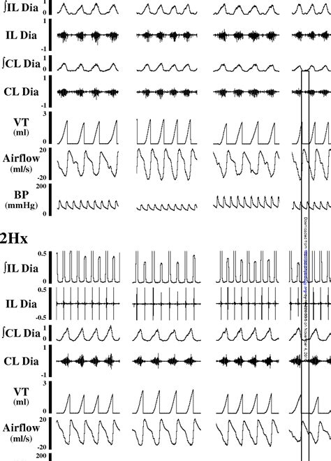 Figure 5 From Effects Of Serotonergic Agents On Respiratory Recovery After Cervical Spinal