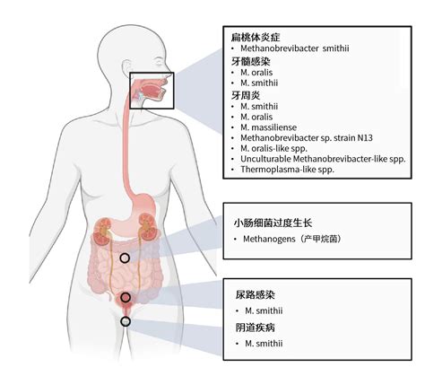 图片解读丨产甲烷菌与小肠细菌过度生长 杭州乐翌生物科技有限公司