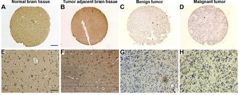 representative images show runx3 immunohistochemical staining a e