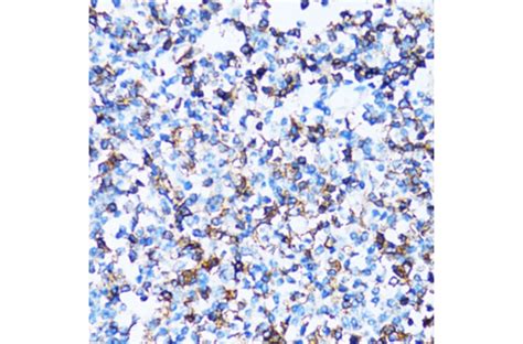 Anti Spn Antibody A9855