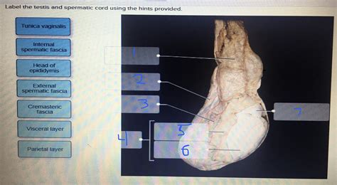 External Spermatic Fascia Cadaver