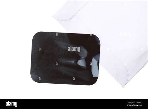 Detail X Ray Image Scan Of Humans Teeth Stock Photo Alamy