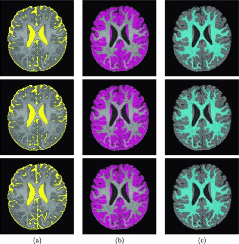 segmentation results for csf a gm b and wm c projected onto