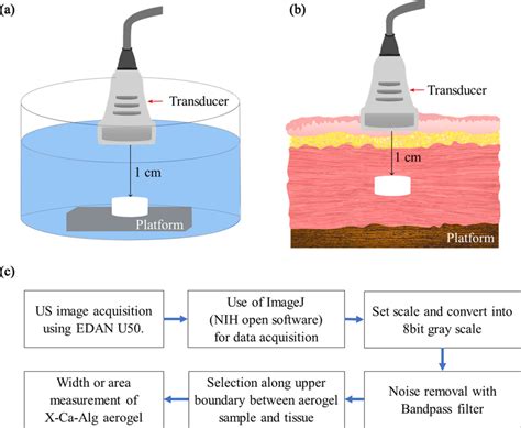 Set Up For A In Vitro And B Ex Vivo Ultrasound Imaging Of X Ca Alg