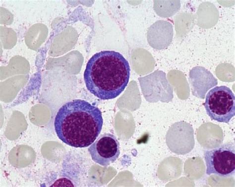 Basophilic Erythroblast