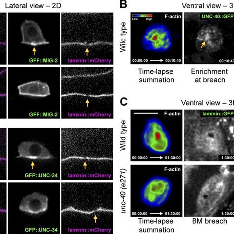 UNC And UNC Promote Invasive Protrusion Formation And Basement Download Scientific Diagram