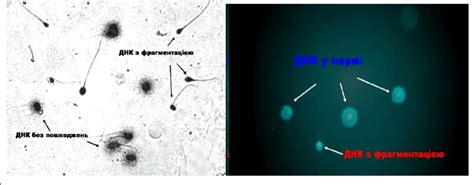 Fragmentation Of Dna In Spermatozoa As Seen By The Method Of Sperm Download Scientific Diagram