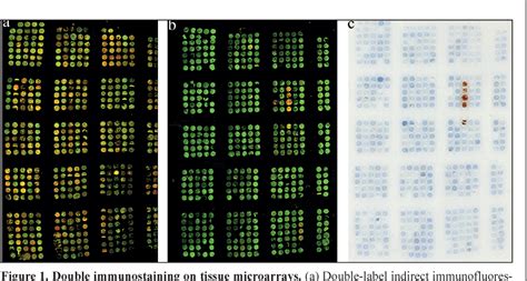 Automated Evaluation And Normalization Of Immunohistochemistry On