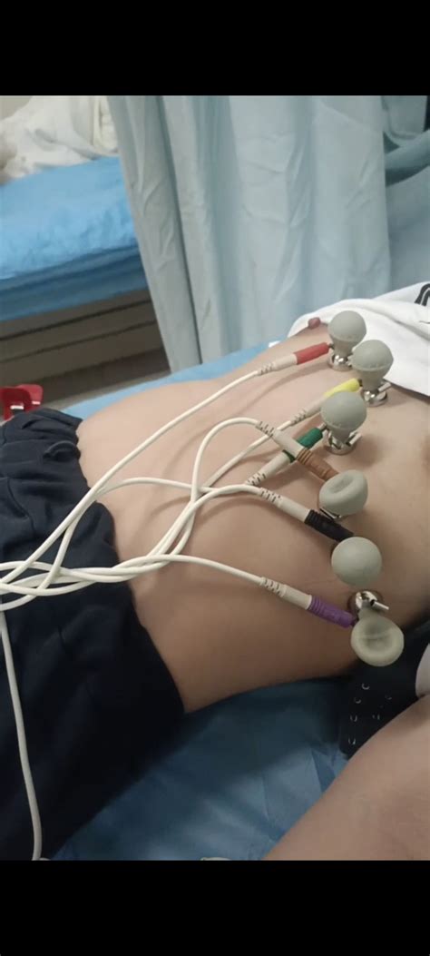 Chinese Wowen ECG Exam ThisVid Com