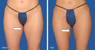 My Non Tour Diary Mind The Gap