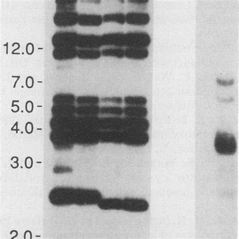 Hybridization Of Rp A To Ecori Digested Genomic Dna From Four